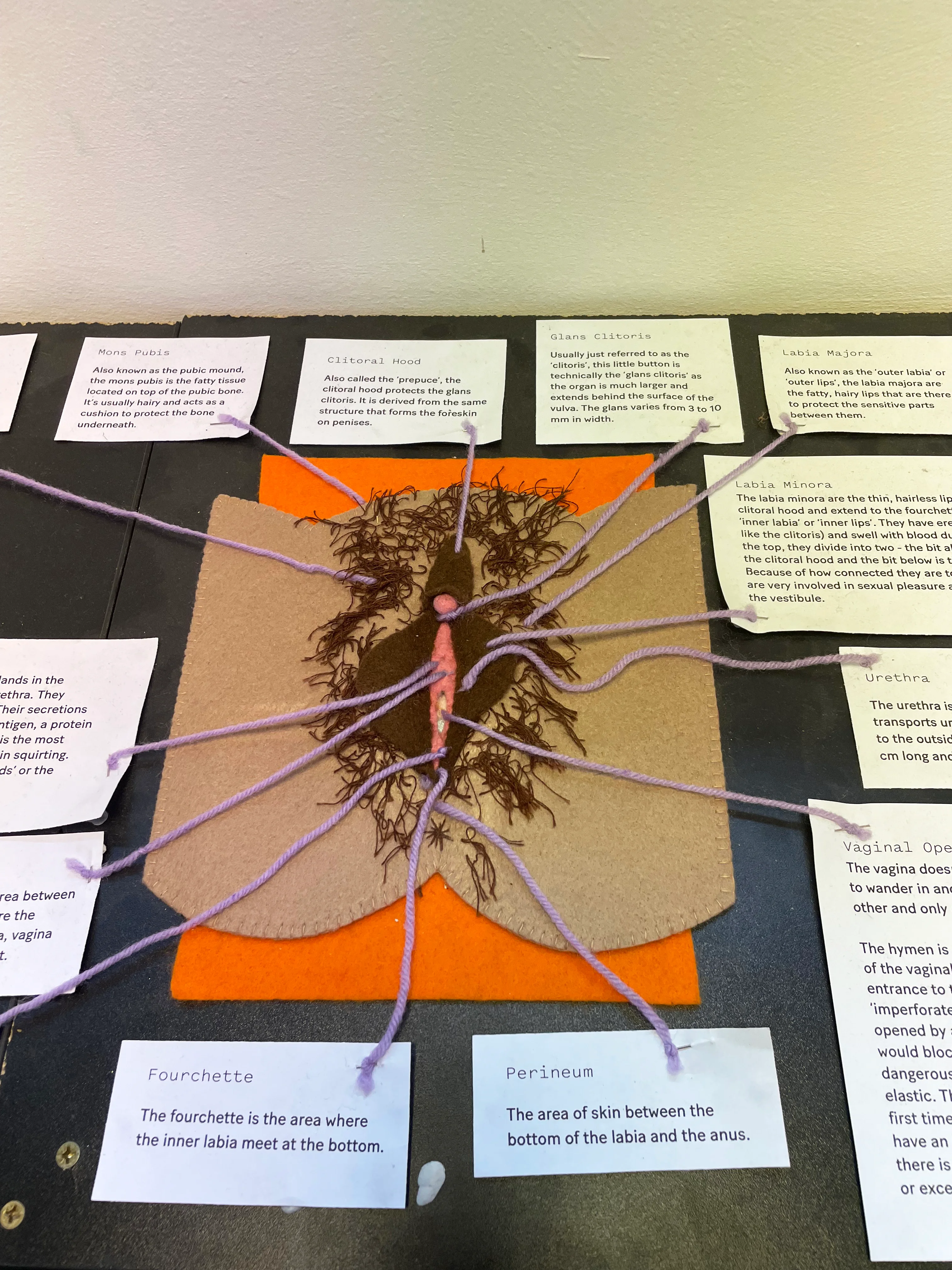 フェミニスト「ロンドンにある「まんこ博物館」にを視察してきました。お土産のまんこグッズが最高」 [377482965]